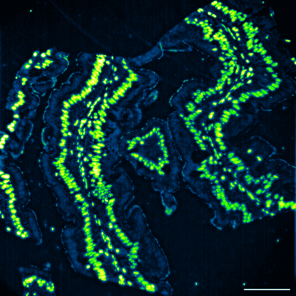 Tissue Sections - Chip Nanoimaging